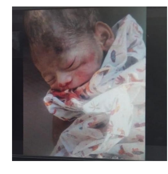 Newborn baby abandoned near shell petrol bunk rescued swiftly by KG ...